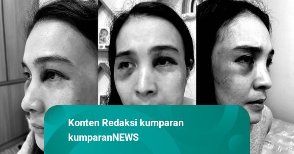 Fakta-fakta di Balik Kasus KDRT Putri Balqis di Depok | kumparan.com Fakta-fakta di Balik Kasus KDRT Putri Balqis di Depok | kumparan.com